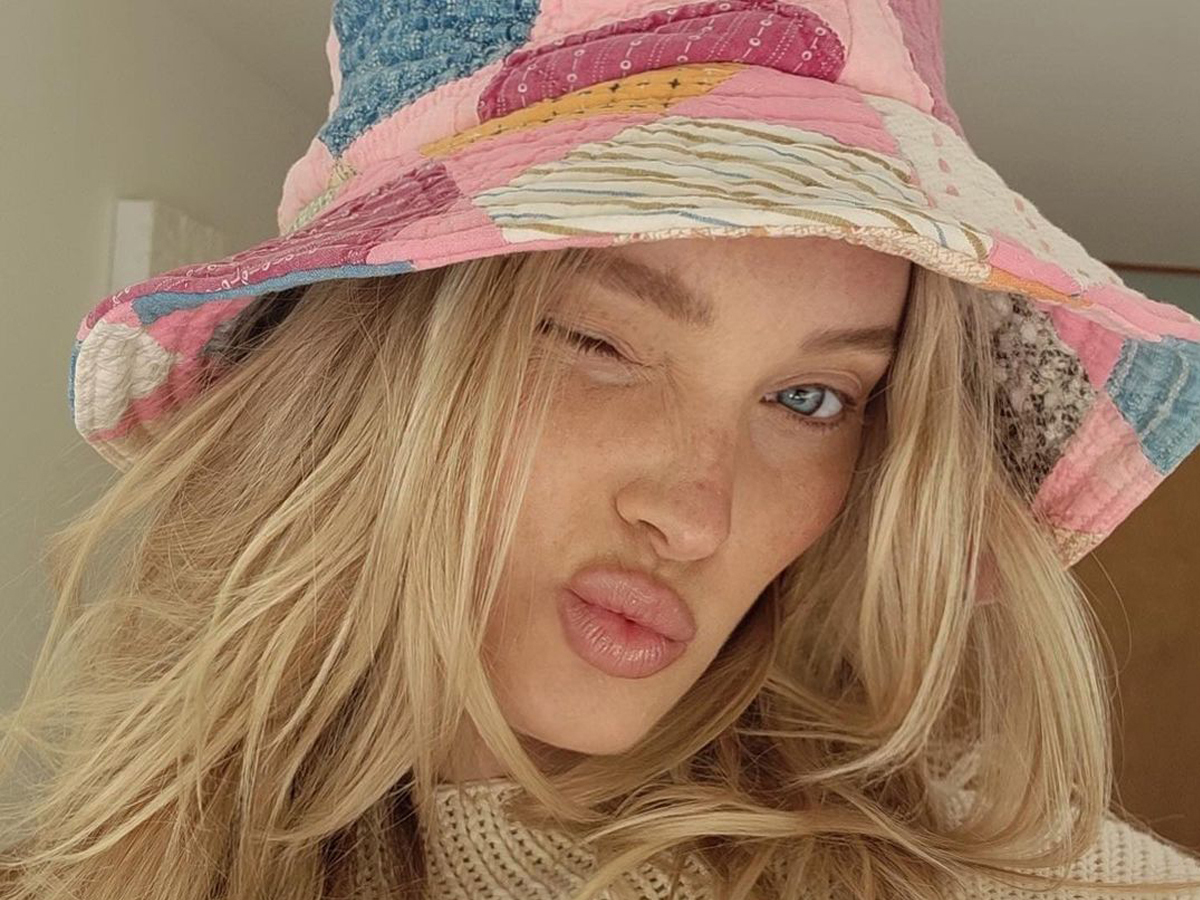 How To Fade & Treat Skin Pigmentation - beautyheaven